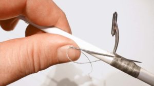 Rutenringe reparieren: So einfach funktioniert es! - BLINKER